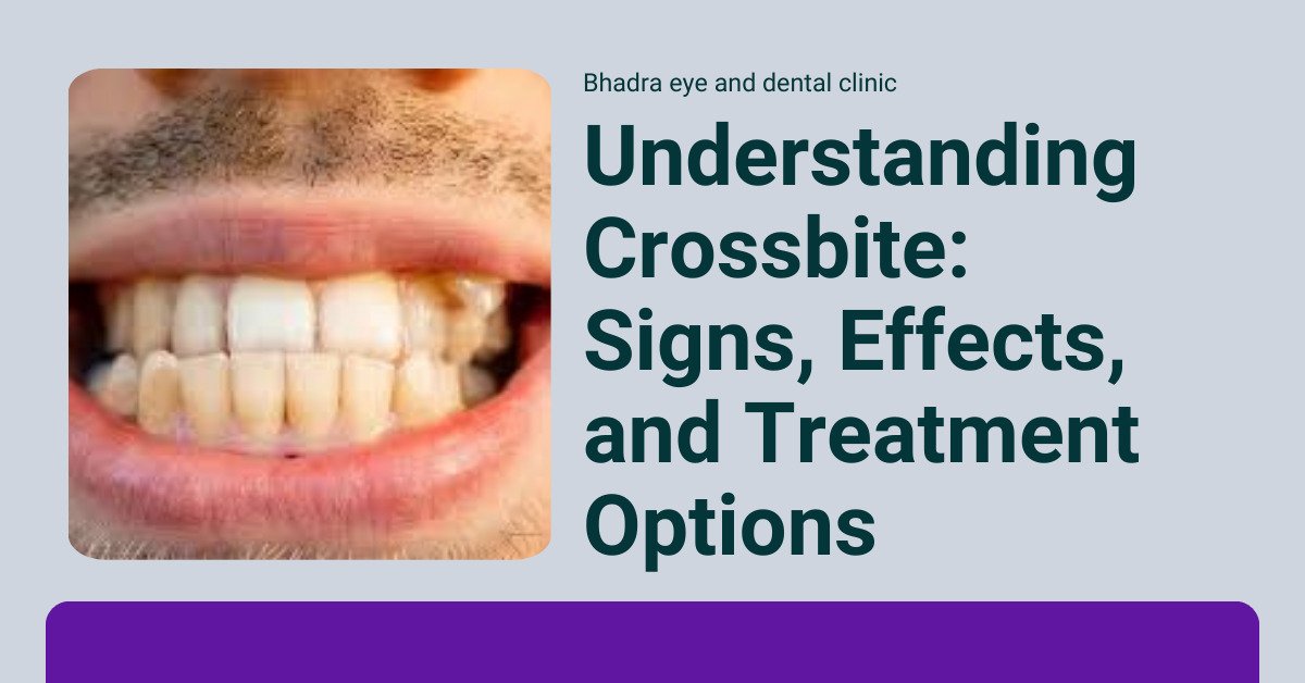 Understanding Crossbite: Signs, Effects, and Treatment Options - bhadra eye dental clinic